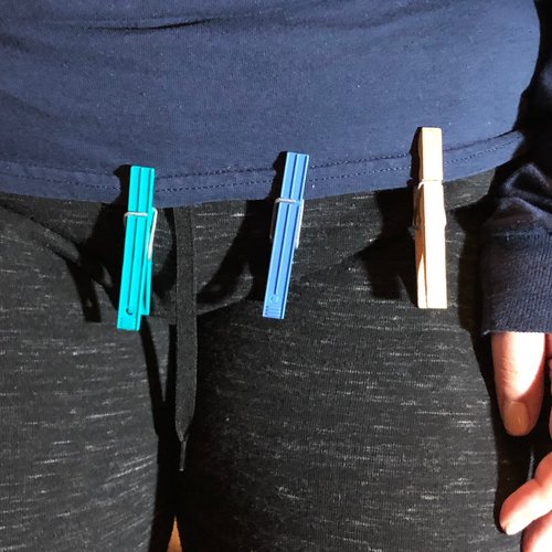 Occupation-Based Intervention in SNFs